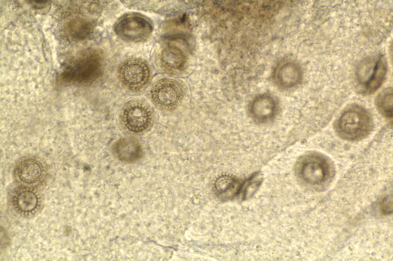 trichodina1 | Blue Ridge Koi & Goldfish